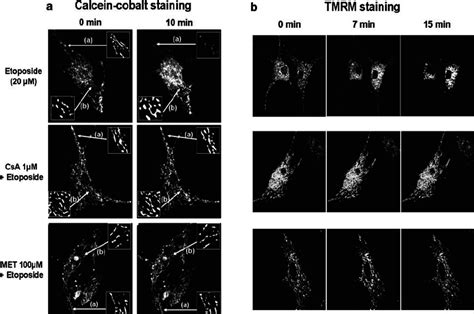 Effects Of Csa And Metformin On Etoposide Induced Ptp Opening And Download Scientific Diagram