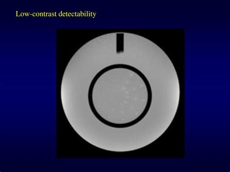 Mri In Breast Imaging Atiyah Yahya Phd Fccpm Ppt Download
