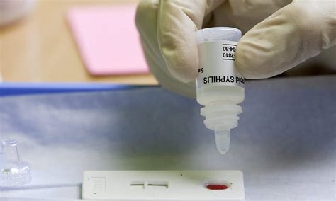 Un antibiotique après un rapport sexuel réduit le risque de MST LFM la radio