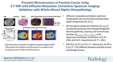 Prostate Microstructure In Prostate Cancer Using 3 T Mri With Diffusion