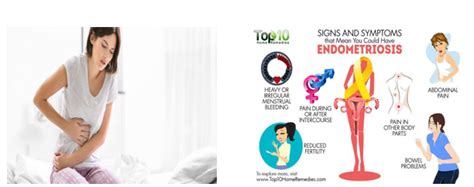 Эндометриоз нь үргүйдэлд хүргэх томоохон шалтгааны нэг юм Unimed