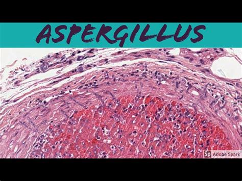 Aspergillus Slide Labeled