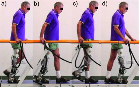 Steady State Gait Phases Of An Amputee Walking From Left To Right A