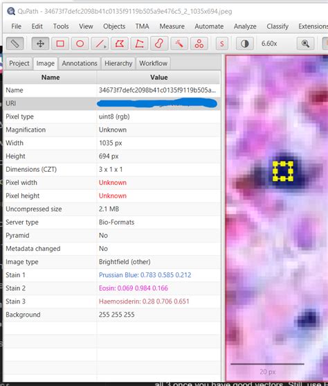 ᴗ• Qupath Scripting 6 Customized 3 Stain Color Deconvolution Usage And Issues Imagesc Forum