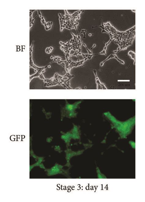 Selective Differentiation Of Ips Cells Into Insulin Producing
