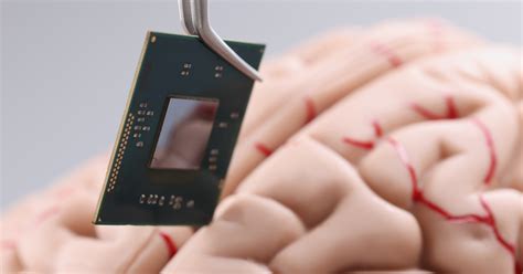 Brain Implant Turns Thoughts Into Speech In Near Real Time • Philstar Life