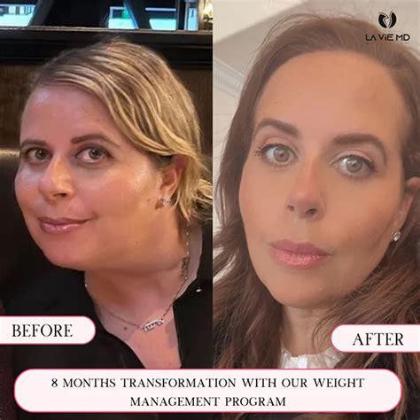 Get Ozempic In The Bay Area Weight Loss With Semaglutide