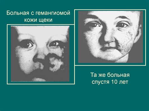 Реферат Лучевая Терапия - ecpriority