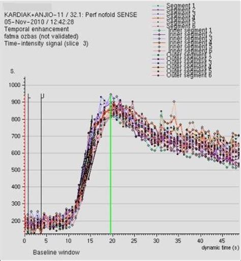 The Curve Of First Pass Perfusion At The Midventricular Level Of A Download Scientific Diagram