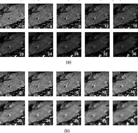 Figure 5 From Fast Compensation Of Brightness Attenuation With Depth In Confocal Laser Scanning