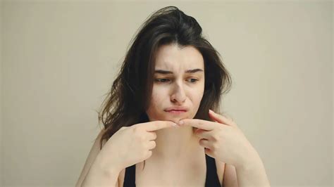 Tips Pakai Pimple Patch Saat Makeup Terbaru Berita Foto Video