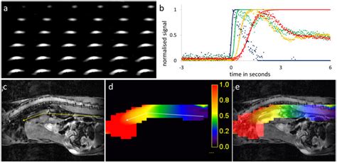 Detection Of The Propagation Of The Tracer By Magnetic Particle Imaging Download Scientific