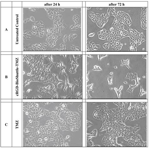 Mcf 7 Cells
