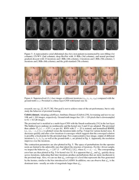 Neural Proximal Gradient Descent For Compressive Imaging Deepai