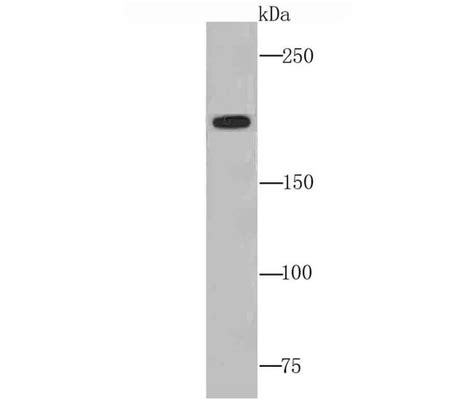 Invitrogen Complement C4 Recombinant Rabbit Monoclonal Antibody Jm88