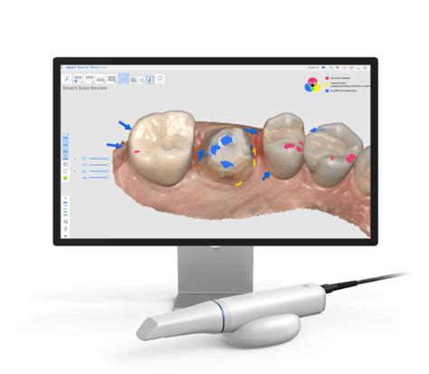 Transforming Your Practice With Medit Intraoral Scanners