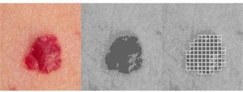 an example of clustering and blocks extracting of roi download