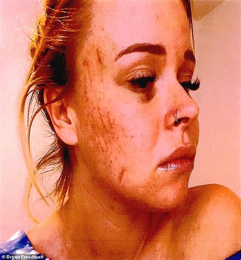 Dodgers Trevor Bauer Allegedly Punched Choked Another Woman Without Consent During Sex