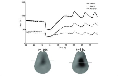 Electrical Impedance Tomography Example Of The Eit Data Collected Download Scientific