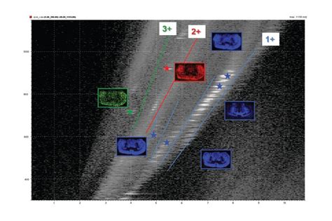 Mass Spectrometry Imaging Desi And Maldi Waters