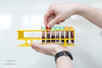 Bachelor Of Health Care Biomedical Laboratory Science Novia Fi