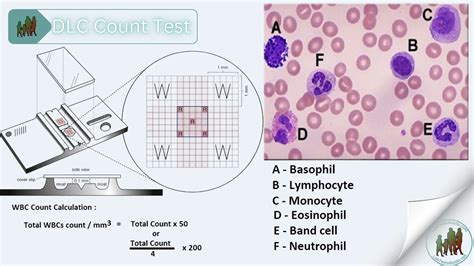 Differential WBC Count Test Procedure Lab Tests Guide