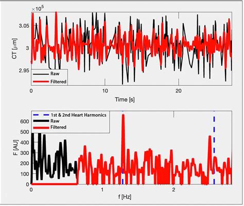 The Noninvasive Measurement Of Ocular Rigidity And The Pulsatile