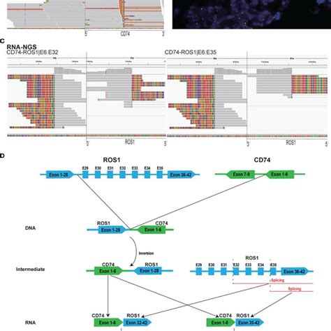 Identification Of A Novel Ros1 Fusion A Dna Ngs Analysis Of The Download Scientific Diagram