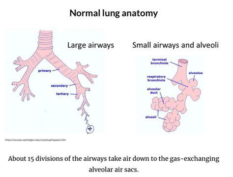Interstitial Lung Disease Flashcards Quizlet