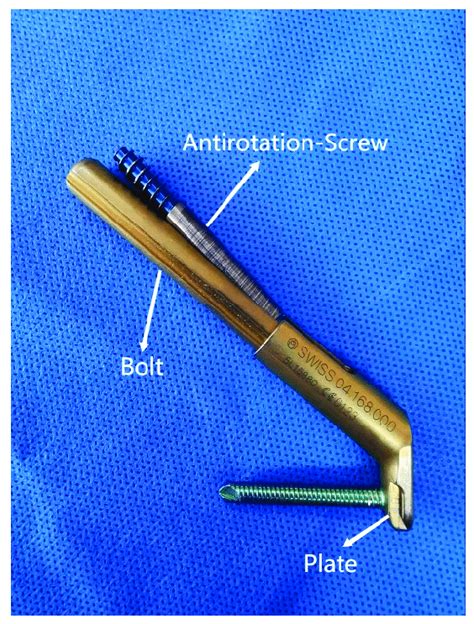 The Fns Consists Of Three Parts The Plate And Locking Screw In The Download Scientific Diagram The Fns Consists Of Three Parts The Plate And Locking Screw In The Download Scientific Diagram