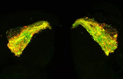 Científicos Desarrollan El ‘primer Tratamiento Que Promete Detener La