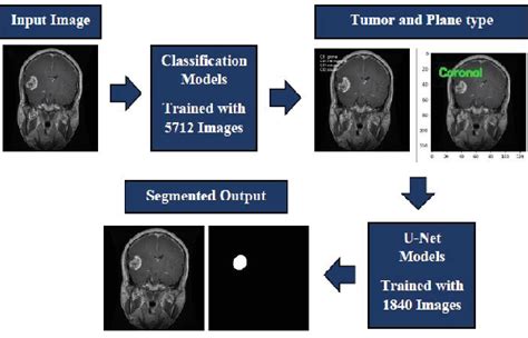 Figure 1 From Deep Learning Assisted Mri Image Segmentation And Classification For Precise Brain