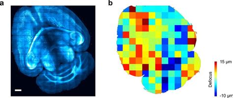 Defocus Variability In Clarified Mouse Brains A Virtual Slab 500 µm Download Scientific