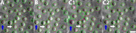 fov pixel sampling optimization comparison of cone segmentation