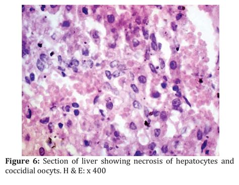 Impression Smear Of Liver Showing Numerous Cholangiocytes Leishman S