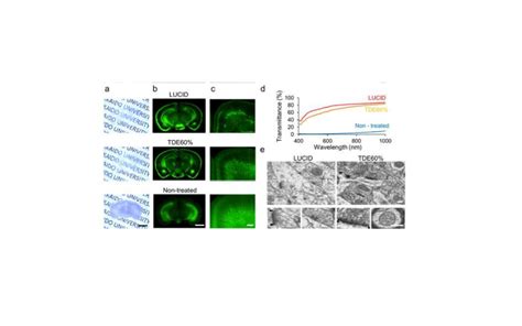Super Resolution Structural Analysis Of Dendritic Spines Using Three Dimensional Structured