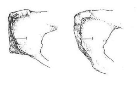Sex Determination Skull And Pelvis Morphological Methods