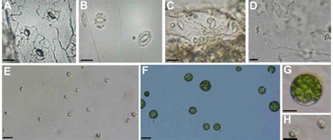Guard Cell Microscope Observing Stomata In Tradescantia Zebrina