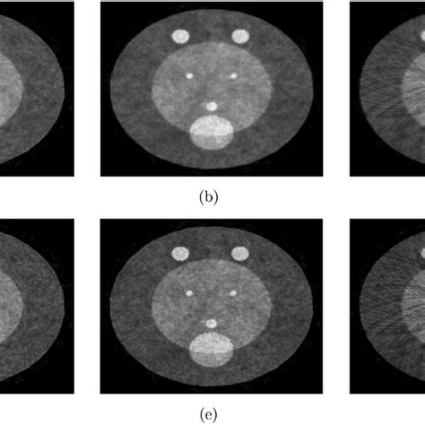 Noisy Images Reconstructed By Use Of 60 Iterations Of The Em Algorithm