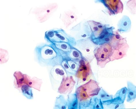 Pin on Imágenes Citológicas