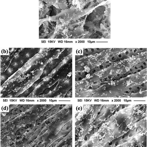 Alp Activity A Col1 B Dspp C And Ocn D Gene Expression The