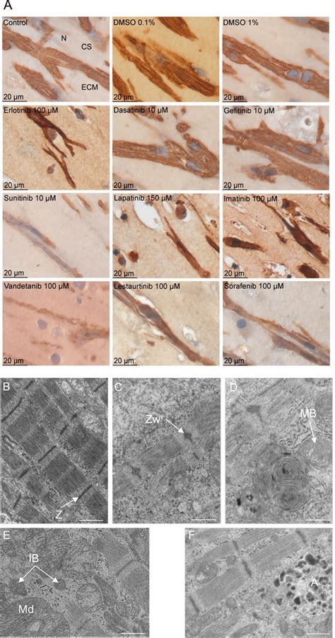 A α Sarcomeric Actin Staining Of Longitudinal Eht Sections In The Download Scientific Diagram
