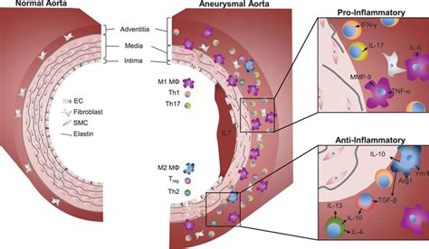 Inflammatory Cell Phenotypes In Aaas Arteriosclerosis Thrombosis And Vascular Biology