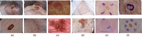 Figure 1 From Dense Deconvolution Net Multi Path Fusion And Dense Deconvolution For High
