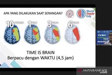 45 Jam Waktu Maksimal Selamatkan Serangan Stroke Antara News