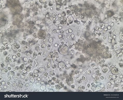 Wbc In Urine