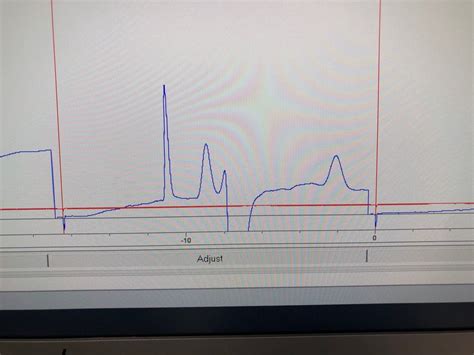 Problem With Peaks Resolution In Hplc Researchgate