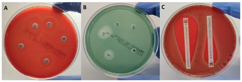Dilution Method Of Antibiotic Sensitivity Test At Fernando Smith Blog