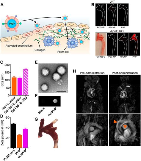 Frontiers Advanced Targeted Nanomedicines For Vulnerable Atherosclerosis Plaque Imaging And
