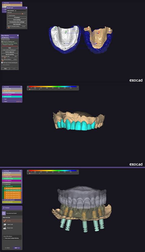 Full Arch Digital Workflow Courses Atlantic Implant Institute